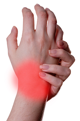 Why Does My Wrist Hurt? You May Have Dorsal Wrist Impingement Syndrome ...